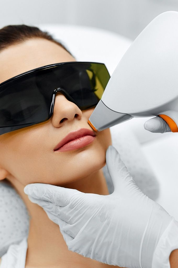 Epilazione laser viso